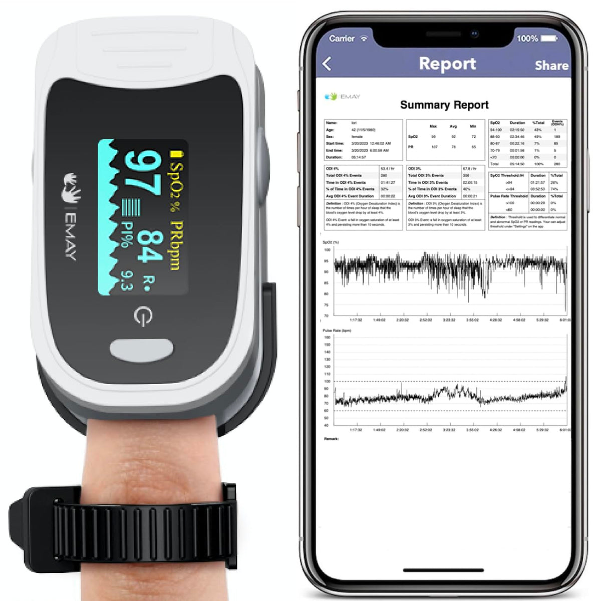 Emay EMO-80 Continuous Pulse Oximeter [Bluetooth] – The Digital Health ...